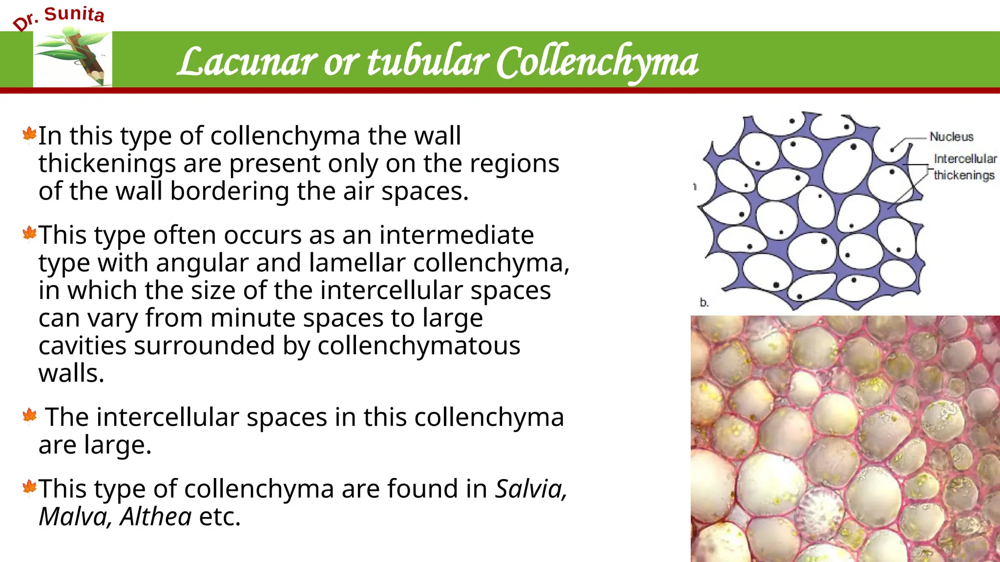 Simple permanent tissue- Parenchyma, Collenchyma and Sclerenchyma | PPTX