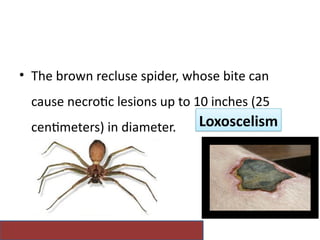 4. necrosis in details. apoptosis also . | PPTX | Blood Disorders ...
