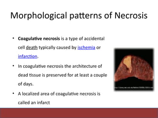 4. necrosis in details. apoptosis also . | PPTX
