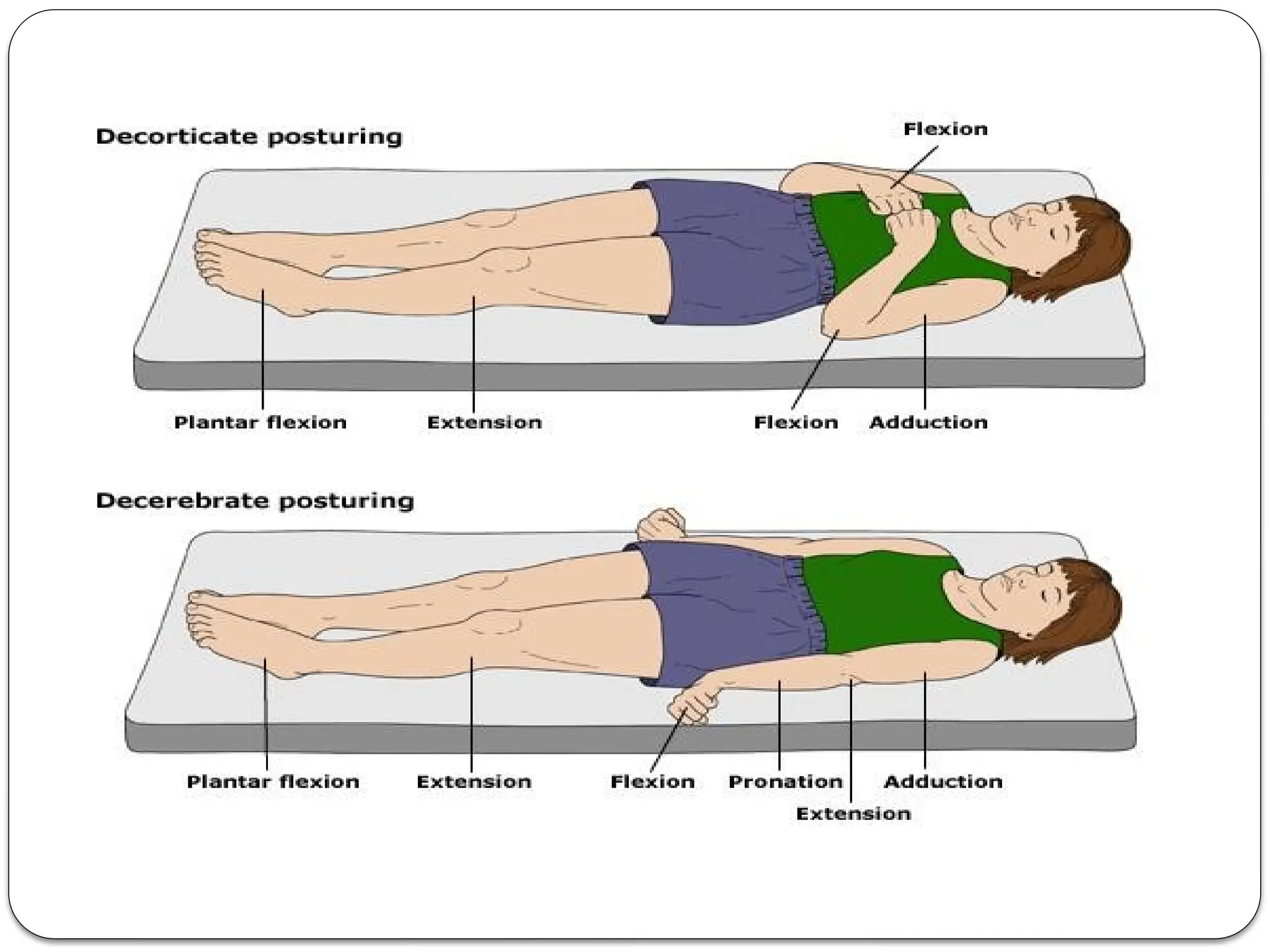 4.Glasgow coma scale for stroke patient.pptx