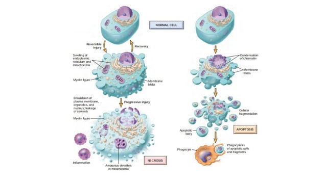 4. Trauma and Cell Injury Modified Remisha.pptx