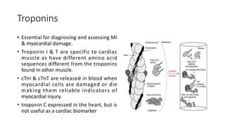4.Cardiac Enzymes and protein in heart disease | PDF