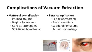 4.24_Vacuum Extraction & Caesarean section_PPT.pptx