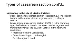 4.24_Vacuum Extraction & Caesarean section_PPT.pptx