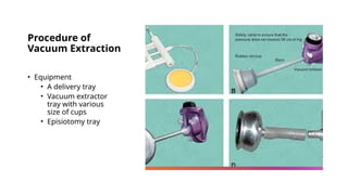 4.24_Vacuum Extraction & Caesarean section_PPT.pptx