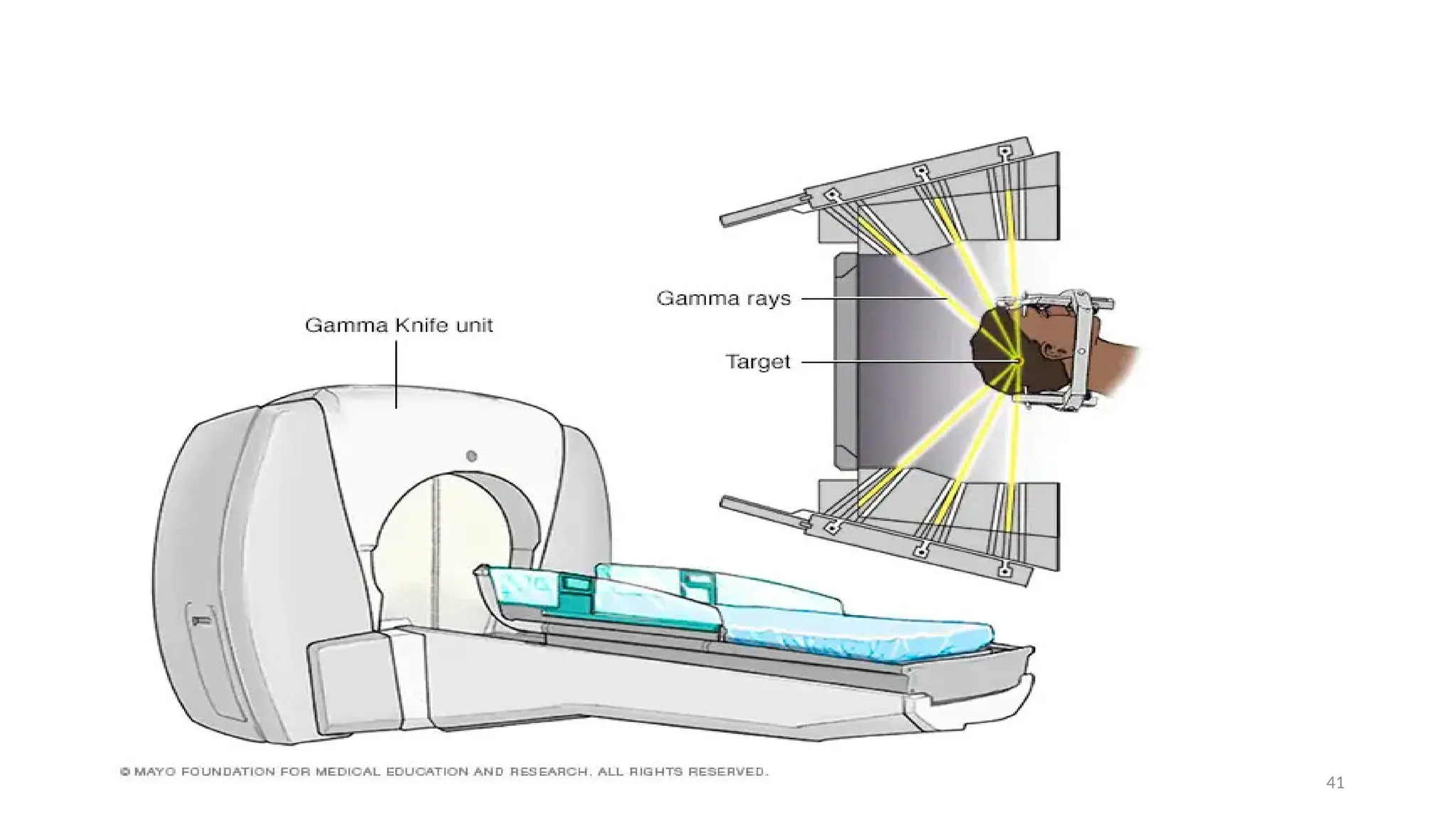 4.Management of Centeral nerous system Tumors (1).pptx