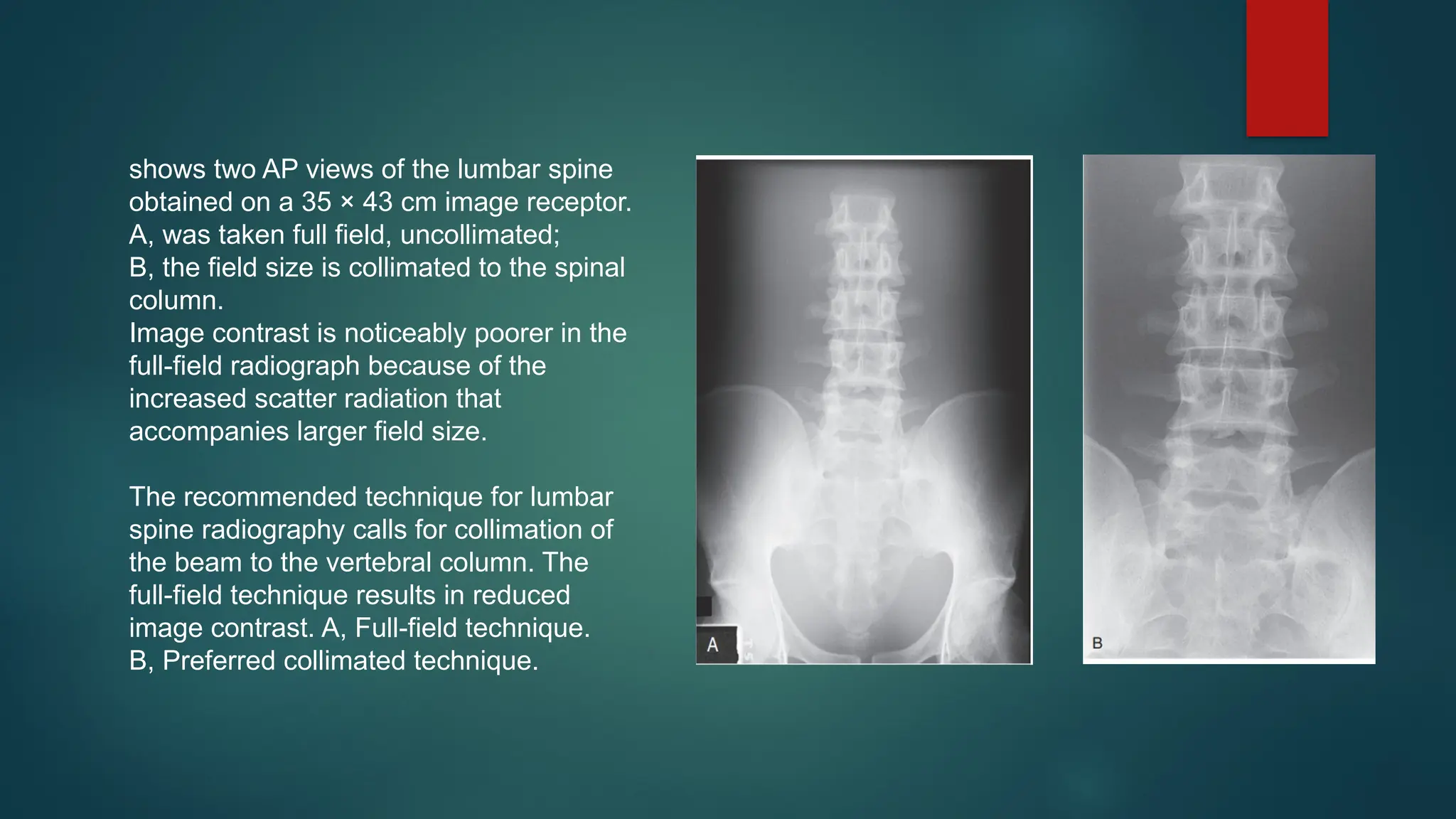 4.SCATTER RADIATION.pptx BY Ravindra Kumar.pptx