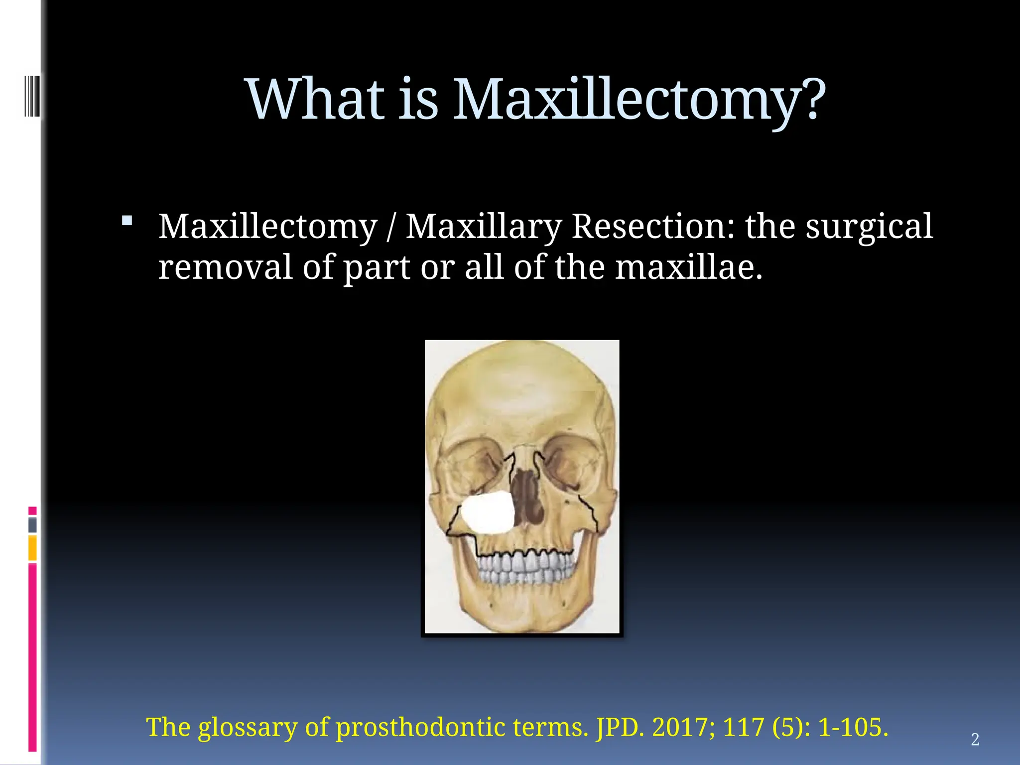 4. Management of Maxillectomy Defect - Kanchan.pptx
