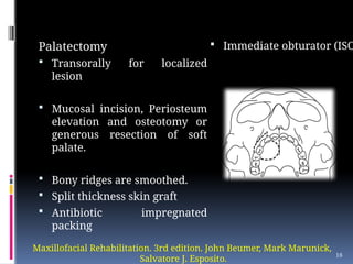 4. Management of Maxillectomy Defect - Kanchan.pptx