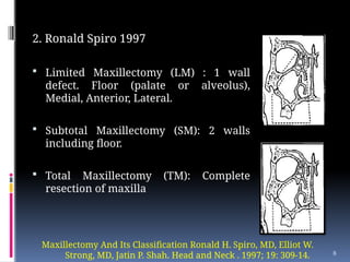 4. Management of Maxillectomy Defect - Kanchan.pptx
