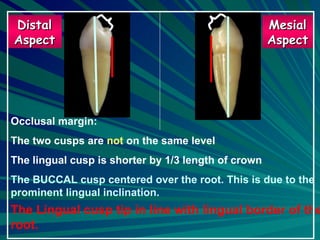 4. .LEC CONS mandibular first premolar.ppt