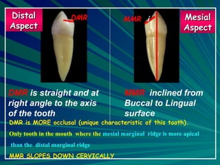 4. .LEC CONS mandibular first premolar.ppt