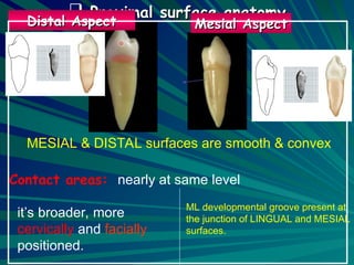 4. .LEC CONS mandibular first premolar.ppt