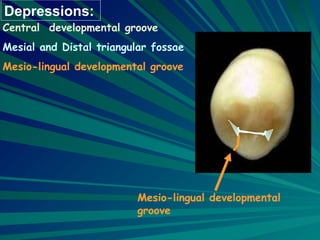 4. .LEC CONS mandibular first premolar.ppt