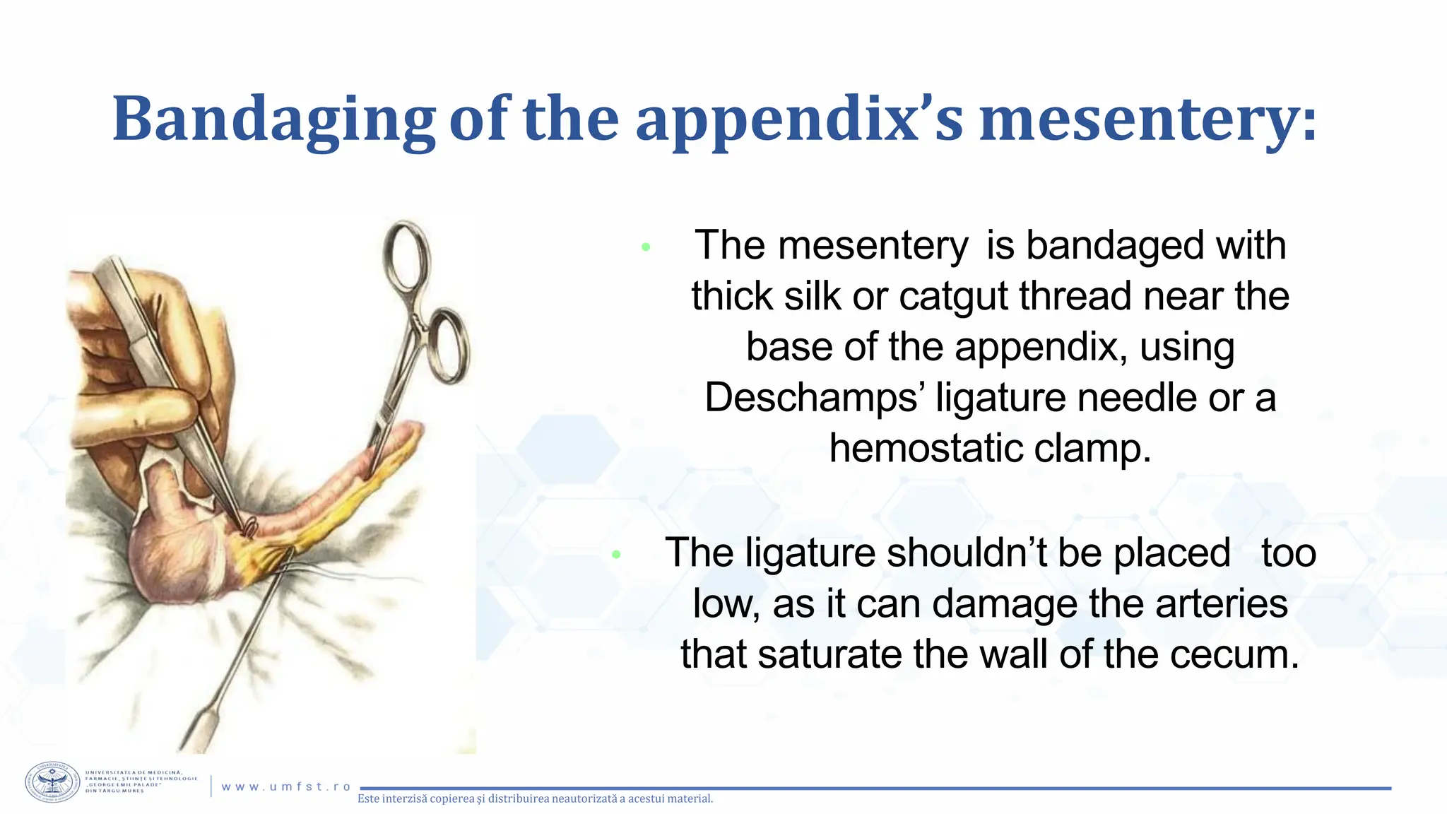 APPENDECTOMY - General Surgery Medicine Course | PDF