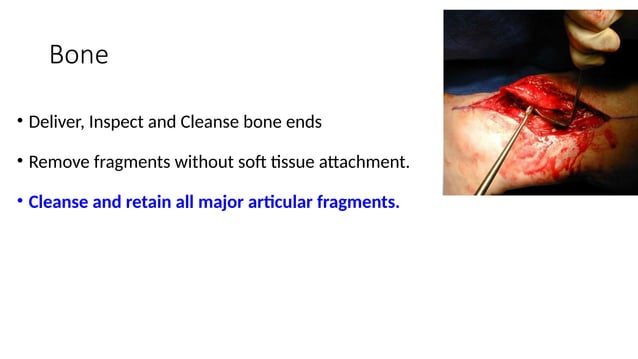 4.Open Fracture management 2..-1 (1).pptx