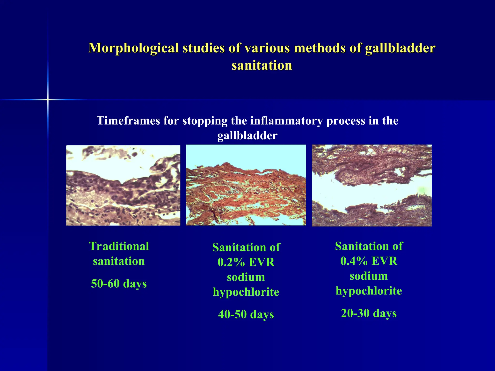 Gallstone disease can lead to several serious complications affecting ...