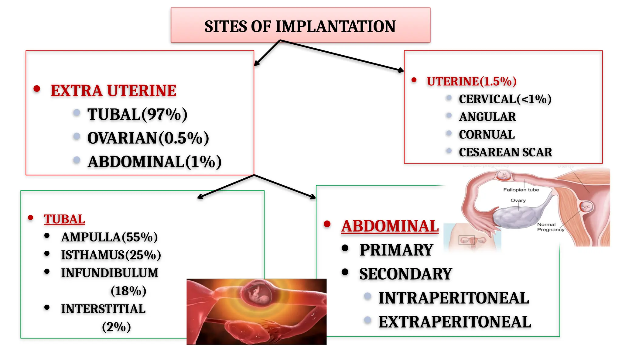 4.ECTOPIC PREGNANCY(0) bleeding in early pregnancy | PPTX