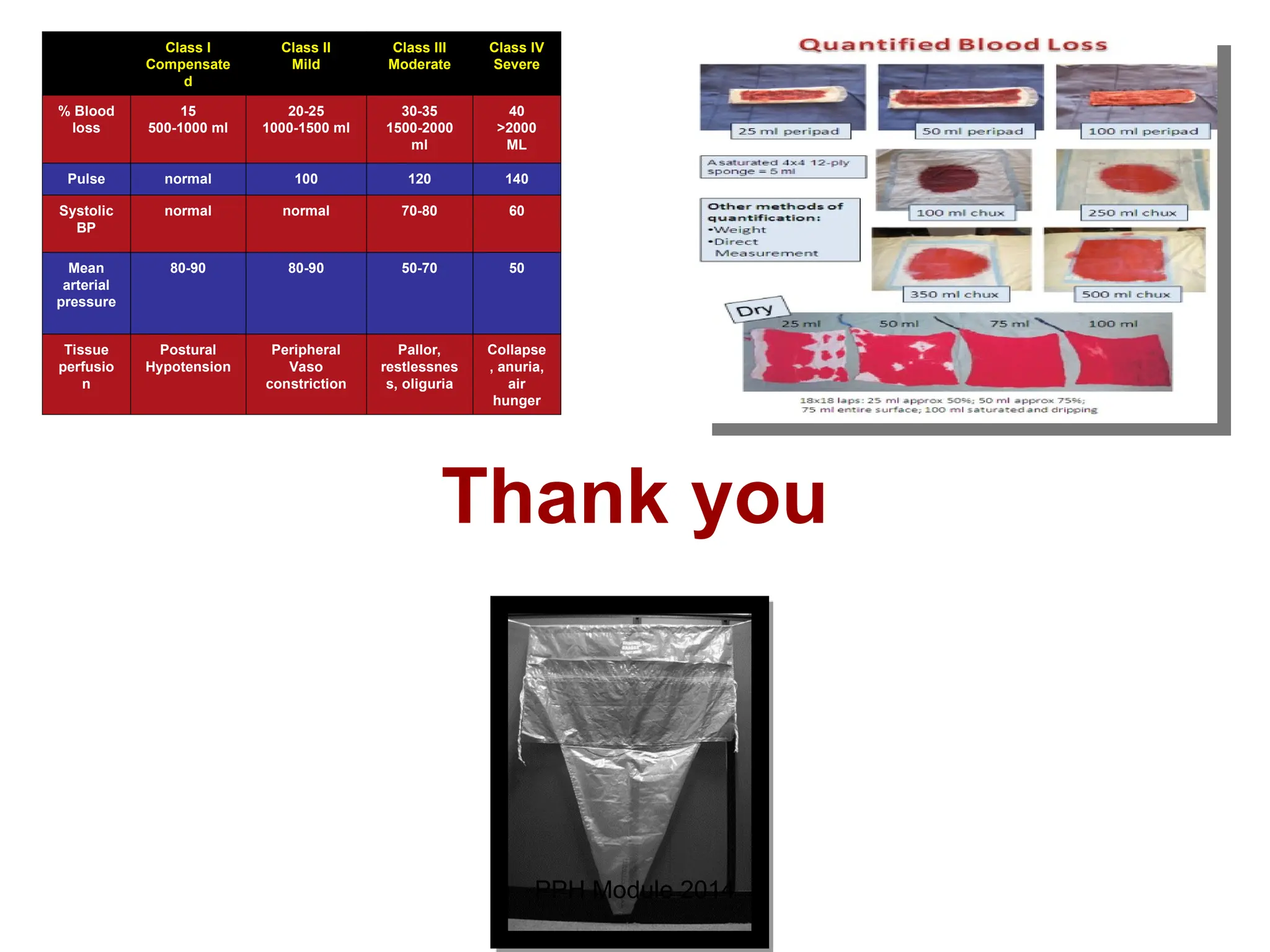 4. Post Partum Haemorrhage Blood loss assessment .ppt