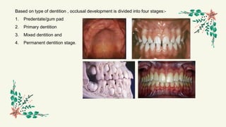 4. development of occlusion seminar.pptx