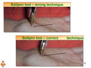 Examination of Nerves. Leprosy Clinical examination | PPTX