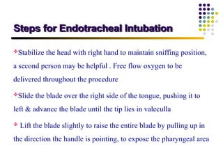 Power point on Endotracheal Intubation 02-04-23.ppt