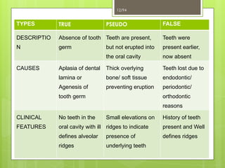 4. Developmental Disturbances.ppt of teeth x | PPTX