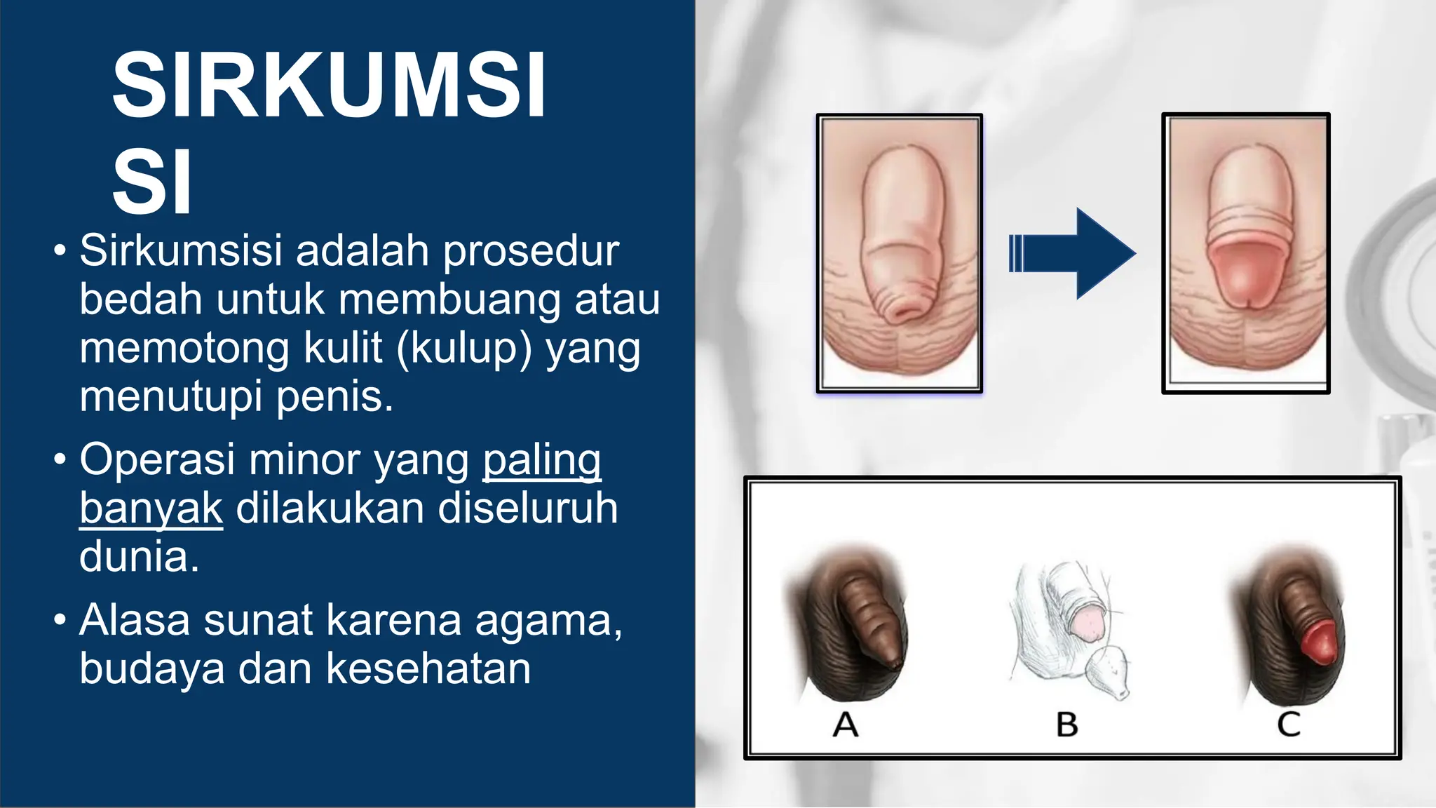 4. SUNAT GEMUK cikandang cikajang garutt | PDF