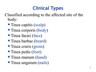 4.Fungal Infection, types, diagnosis, and management | PPTX