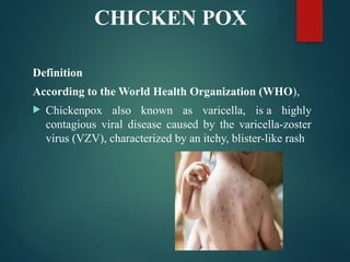 4. Chicken pox.pptx best explanation about chicken pox disease | PPTX