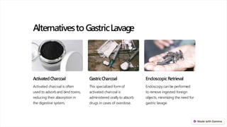Comprehensive Guide to Gastric Lavage: Procedure, Indications, Risks ...
