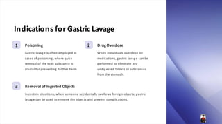 Comprehensive Guide to Gastric Lavage: Procedure, Indications, Risks ...