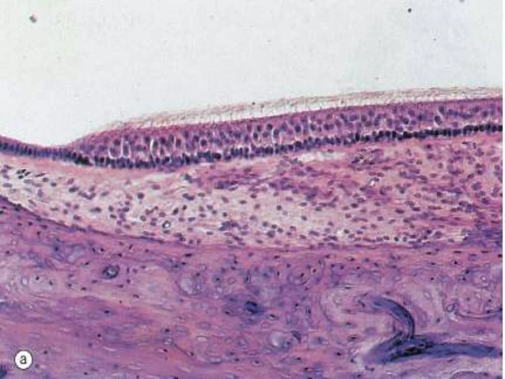 Ear histology | PPTX