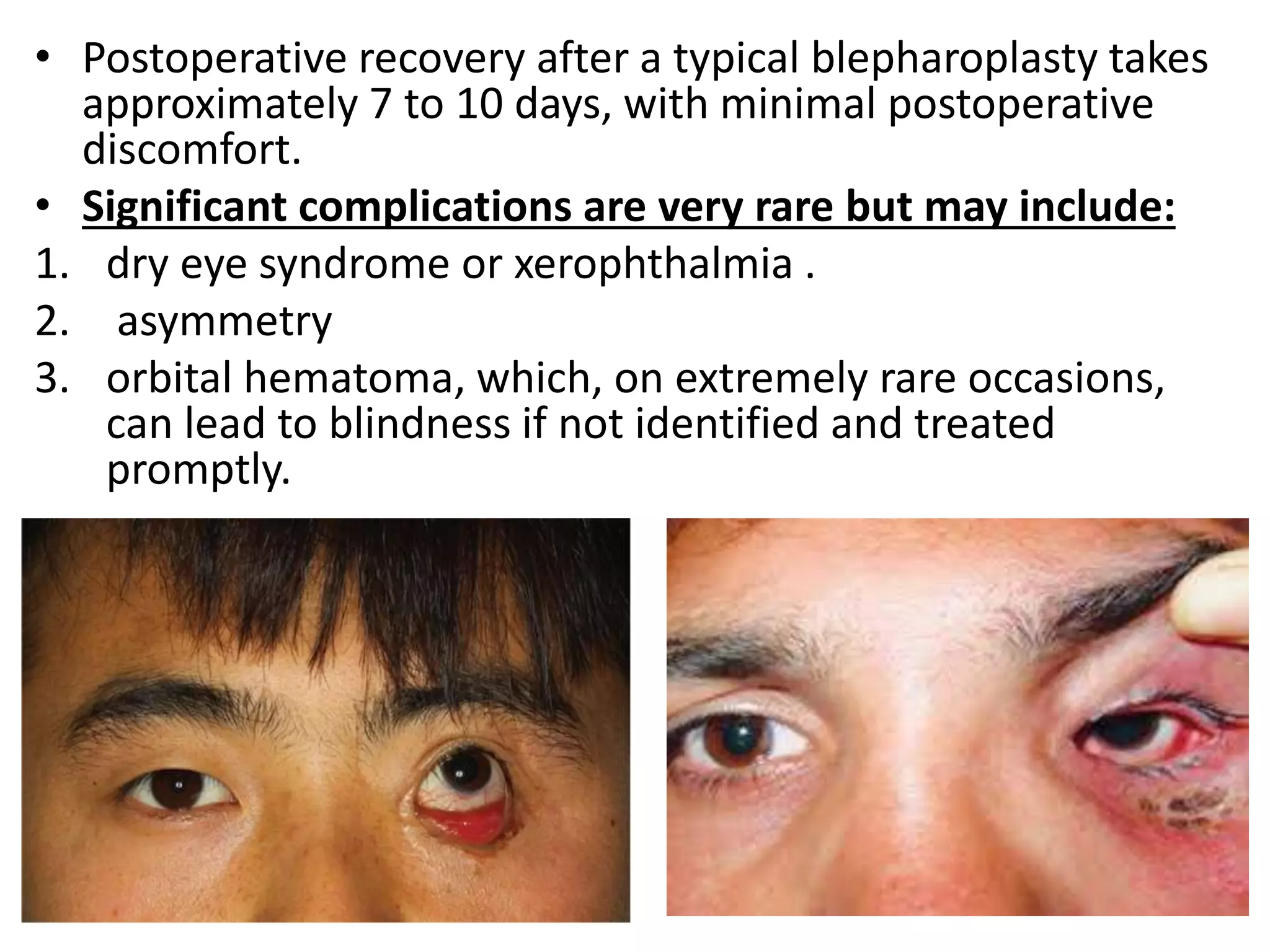Lecture 2 Facial cosmatic surgery | PPTX | Eye and Vision Conditions ...