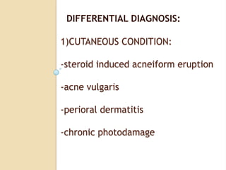 4 acne rosacea (1) | PPT