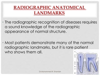 4-Anatomical landmarks_710a6d2064eab9067638e1a14dcc5fa5.pdf