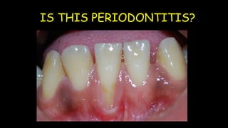 4- A word about New classification.pptx