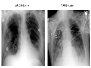 4-Breathing_difficulties(1).pptx | Lung and Respiratory Health ...