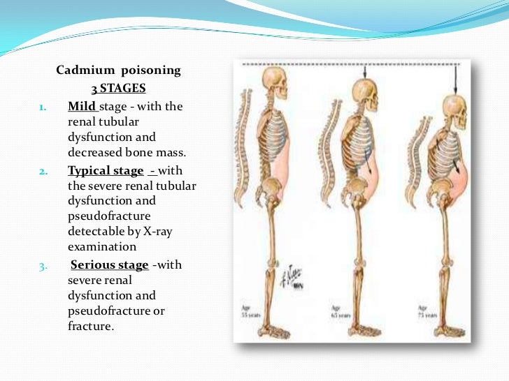 Cadmium Poisoning Ocean Acidification Increases Cadmium Accumulation