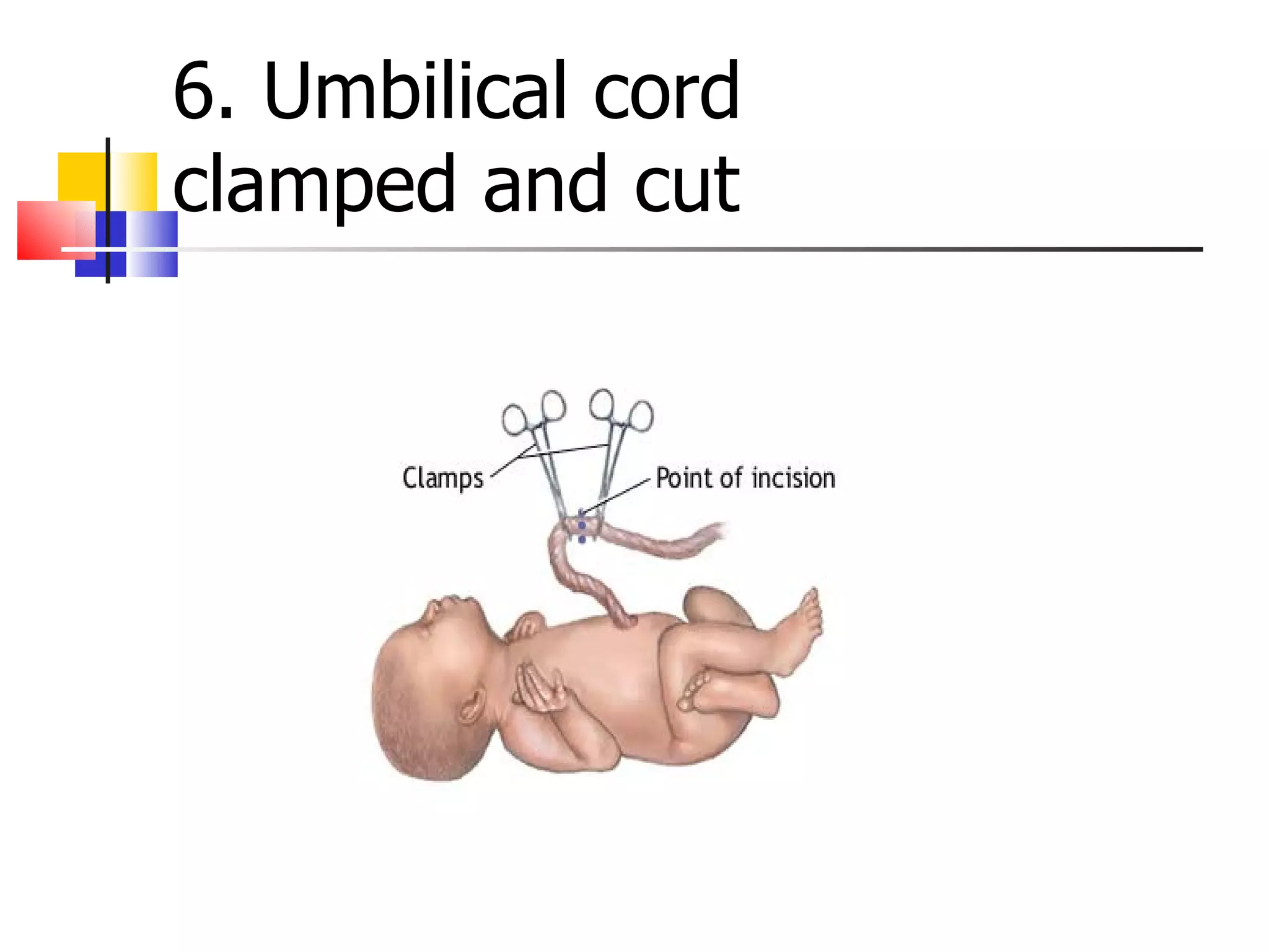 Caesarean section by UM | PPT | Pregnancy | Reproductive Health