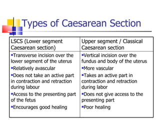 Caesarean section by UM | PPT | Pregnancy | Reproductive Health