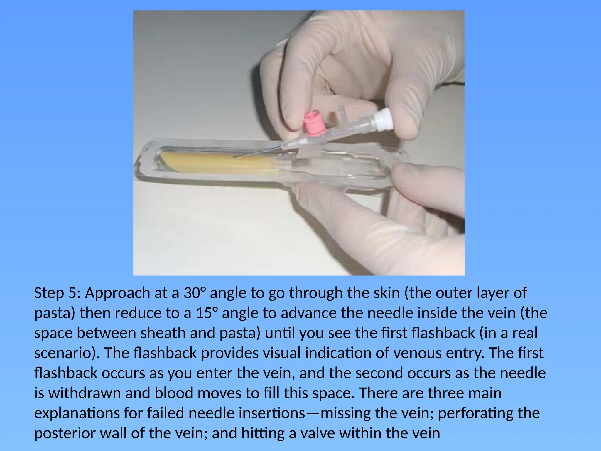 IV Cannula and procedure of iv cannulation.pptx