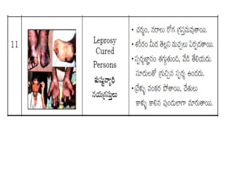 4-CATEGORIES OF CWSN-Types of disability as per RPWD-2016.pptx