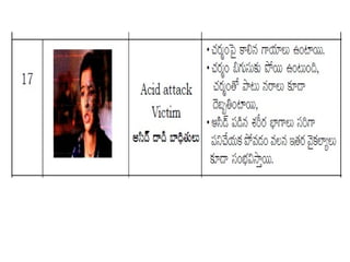 4-CATEGORIES OF CWSN-Types of disability as per RPWD-2016.pptx