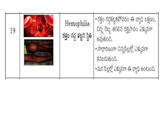 4-CATEGORIES OF CWSN-Types of disability as per RPWD-2016.pptx