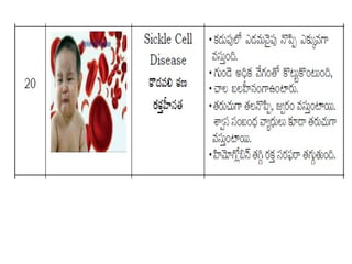 4-CATEGORIES OF CWSN-Types of disability as per RPWD-2016.pptx