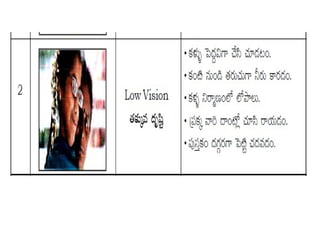 4-CATEGORIES OF CWSN-Types of disability as per RPWD-2016.pptx