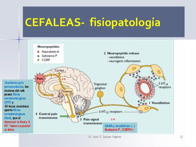 4 cefalea-algias craneofaciales-2016