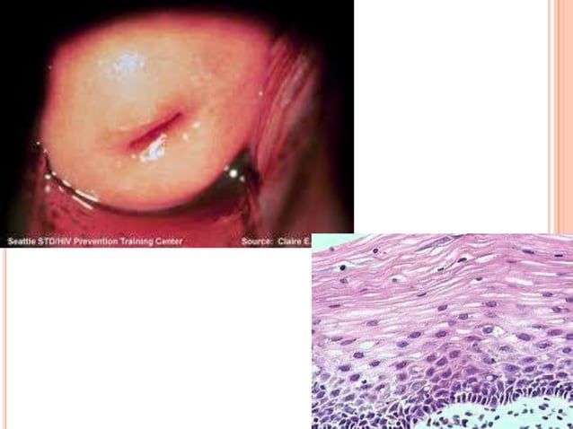 4. Cellular Aberration | PPTX