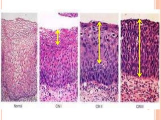 4. Cellular Aberration | PPTX